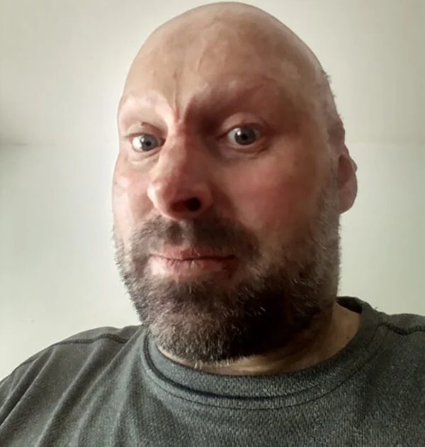 Johan offrade nästan sitt eget liv för att rädda sina grannar: "men så ...